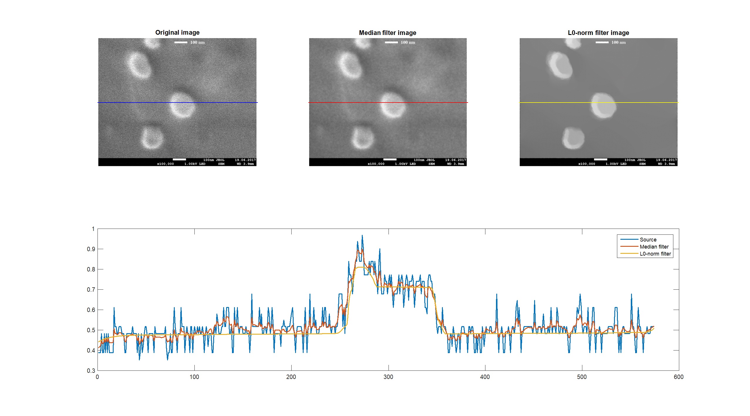 Medical Imaging & Analysis – Ghent Analysis & PDE Center